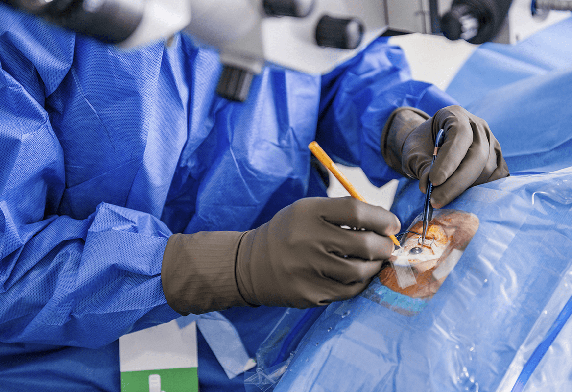 Pterygium Surgery | Laser Pterygium Surgery | CODET Vision Institute